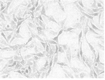 Methods to estimate Cell Confluency - Cellculture2